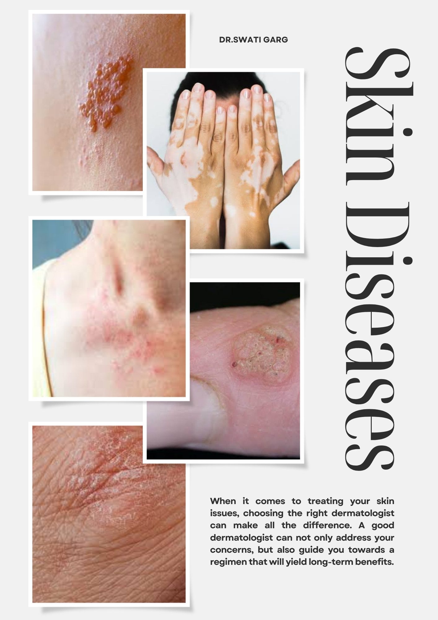 Skin Disease Treatment by Dermatologist - Smart Skin Solutions